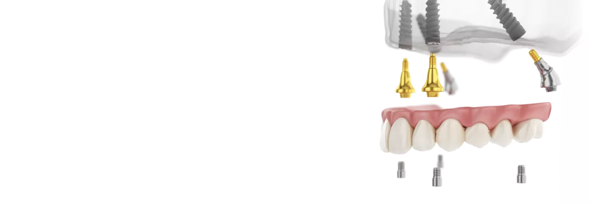 Alpha Bio Tec. - Dental Implants Manufacturer